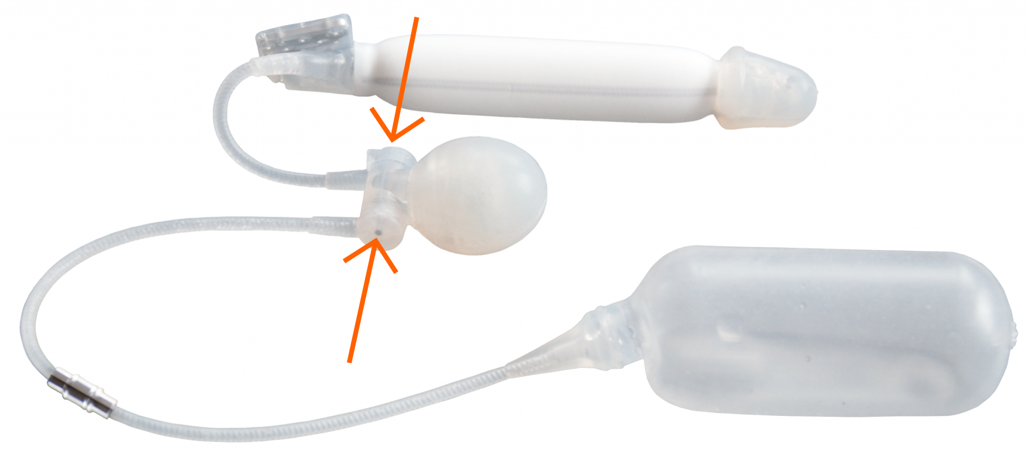 Using the pump - Zephyr Surgical Implants